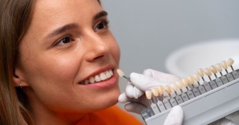 Common Issues with Dental Veneers and How to Fix Them